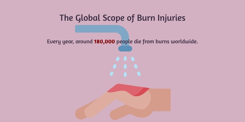 10 Shocking Burn Injury Statistics Everyone Should Know